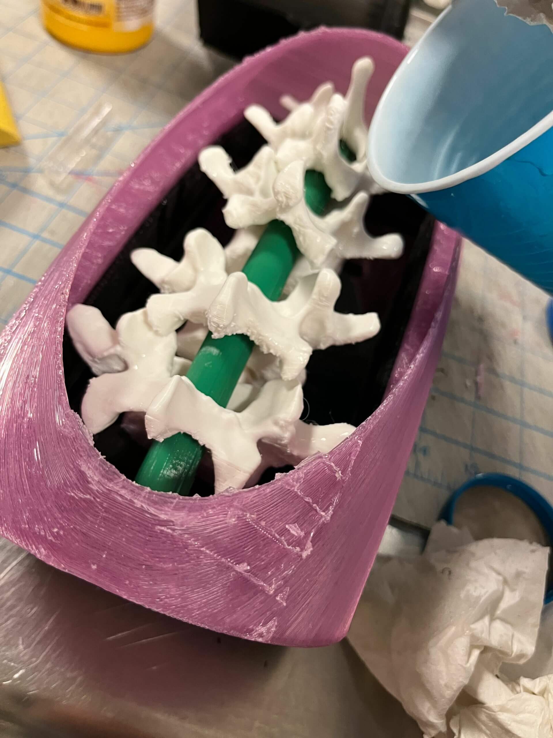 UCSF Lumbar Puncture Simulator Project - UCSF Library